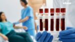 What is the Next Step After Medical Test For Canada Immigration